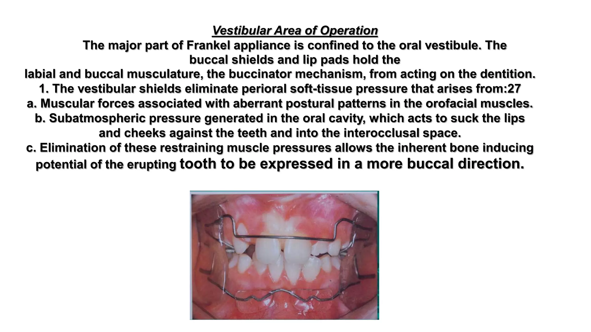 Removable functional appliance 3 | PPTX