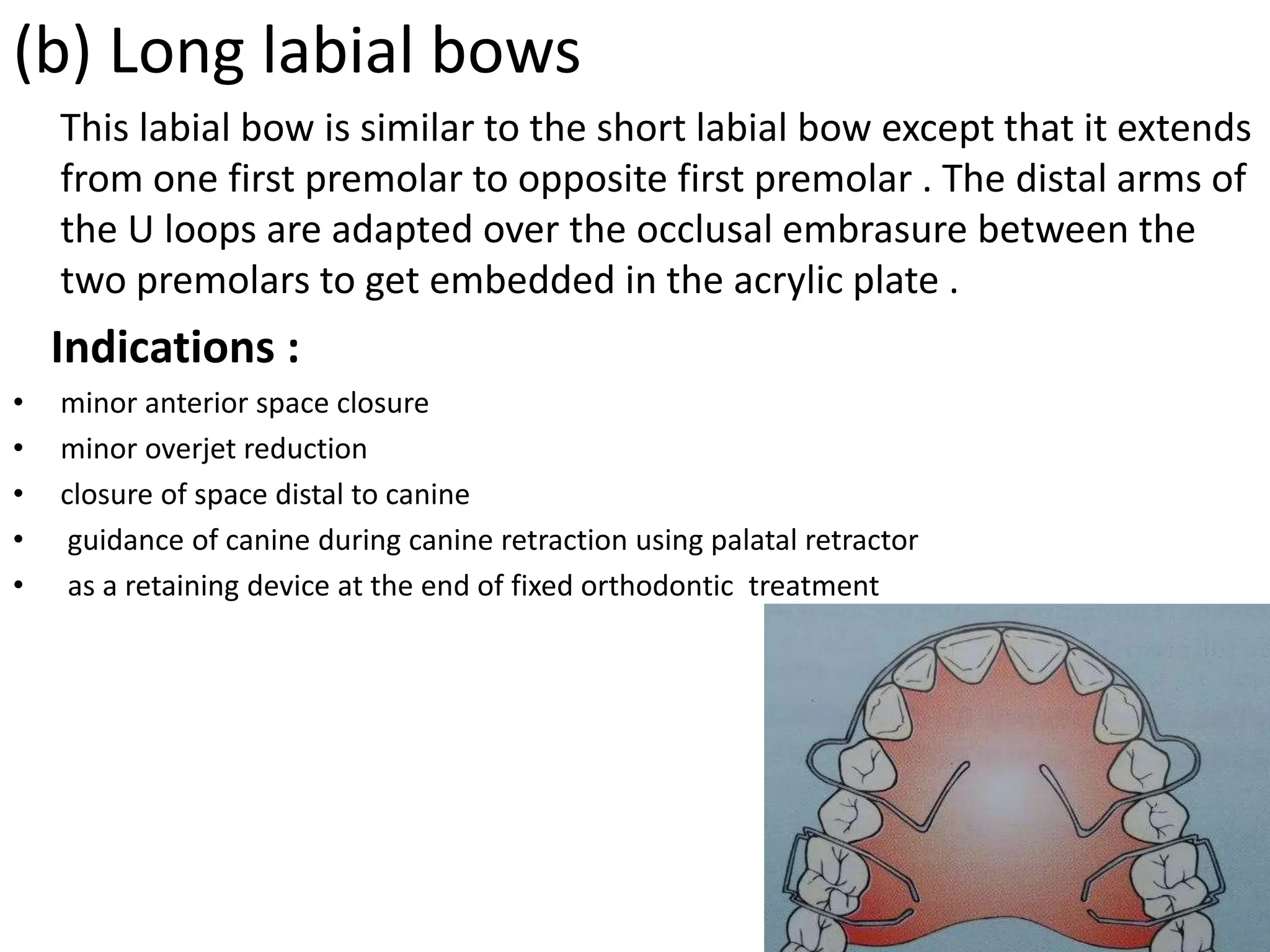removable orthodontic appliences for UG.pdf