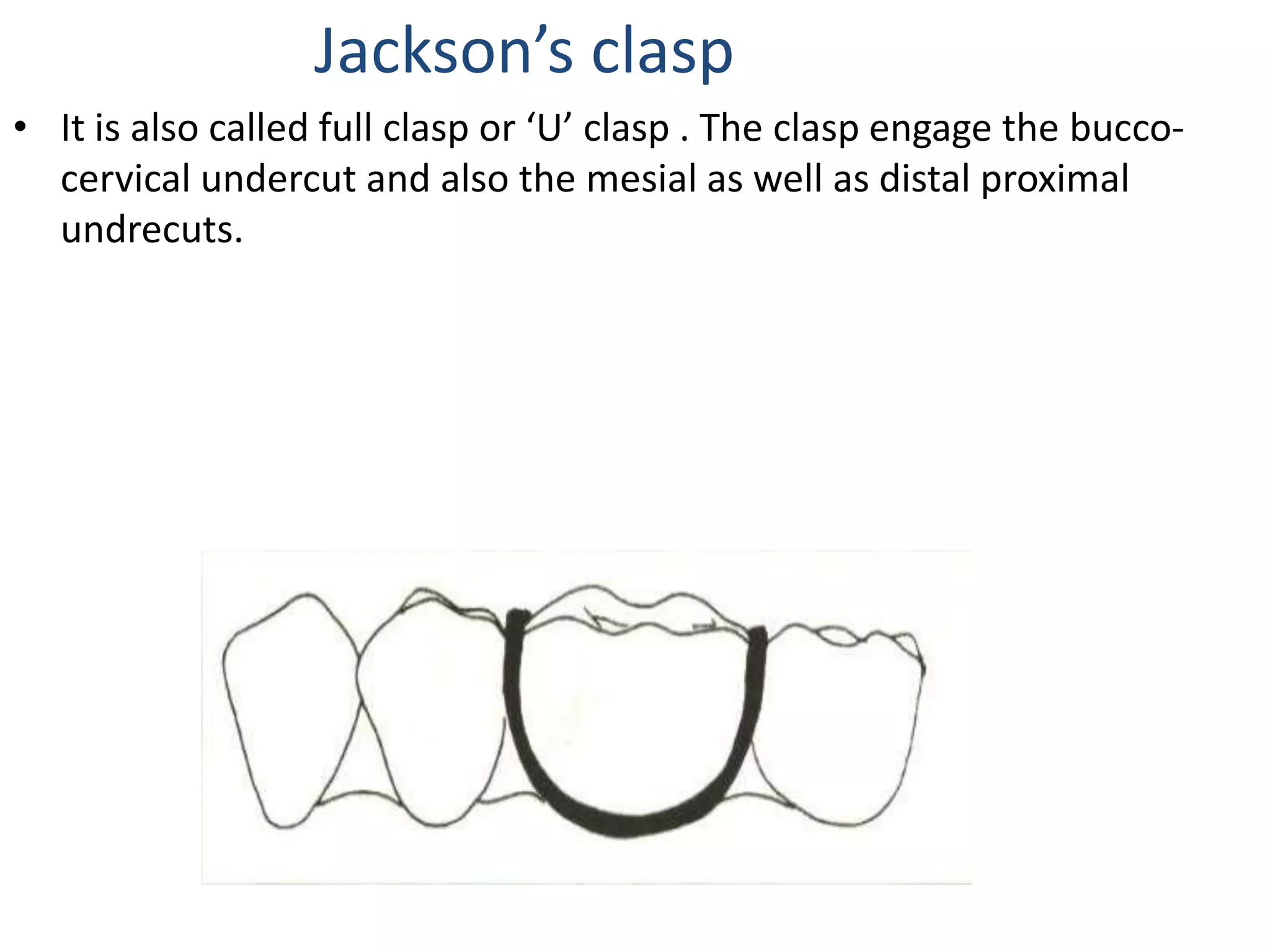 Removable orthodontic appliance | PPTX