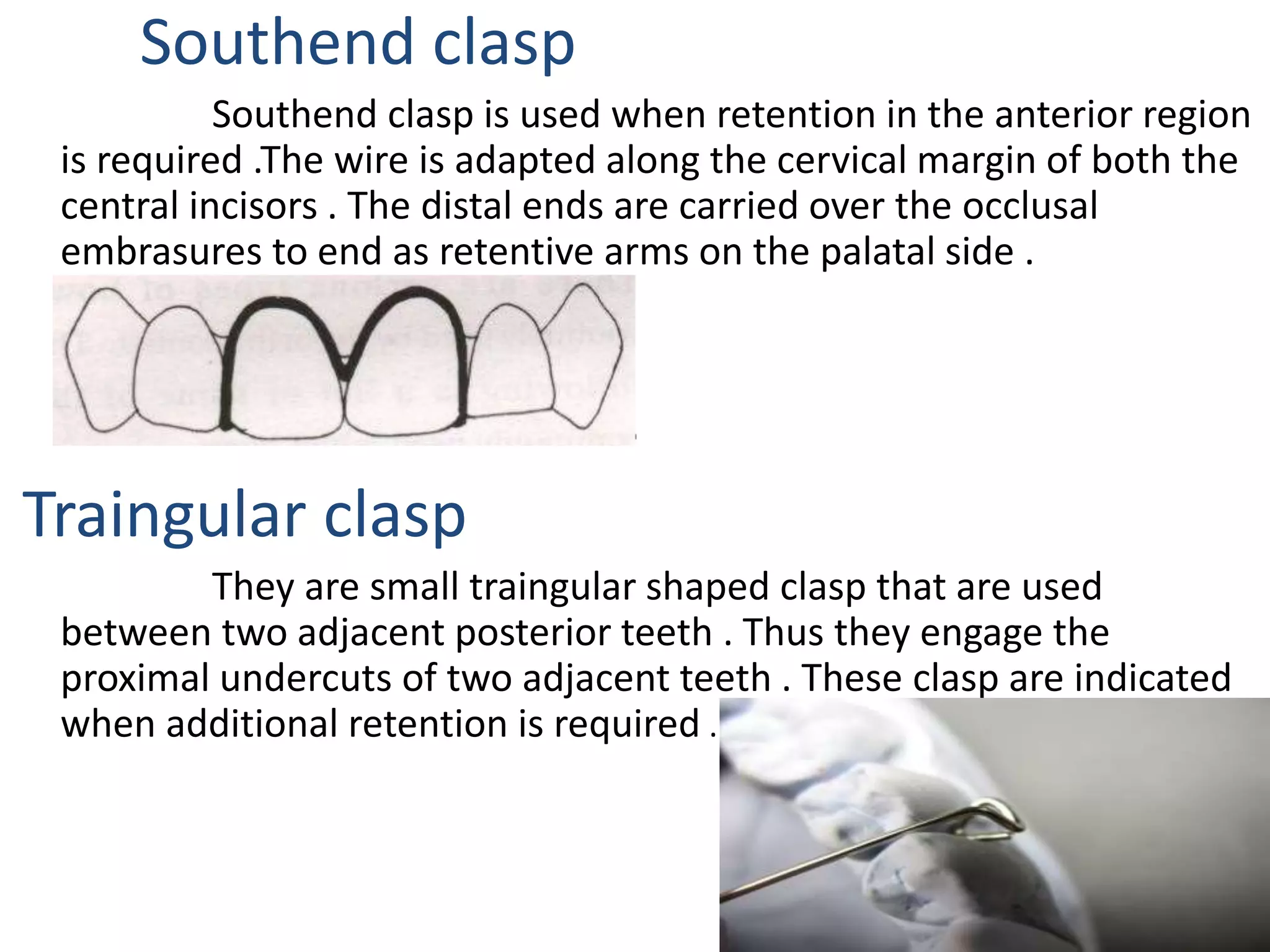 Removable orthodontic appliance | PPTX