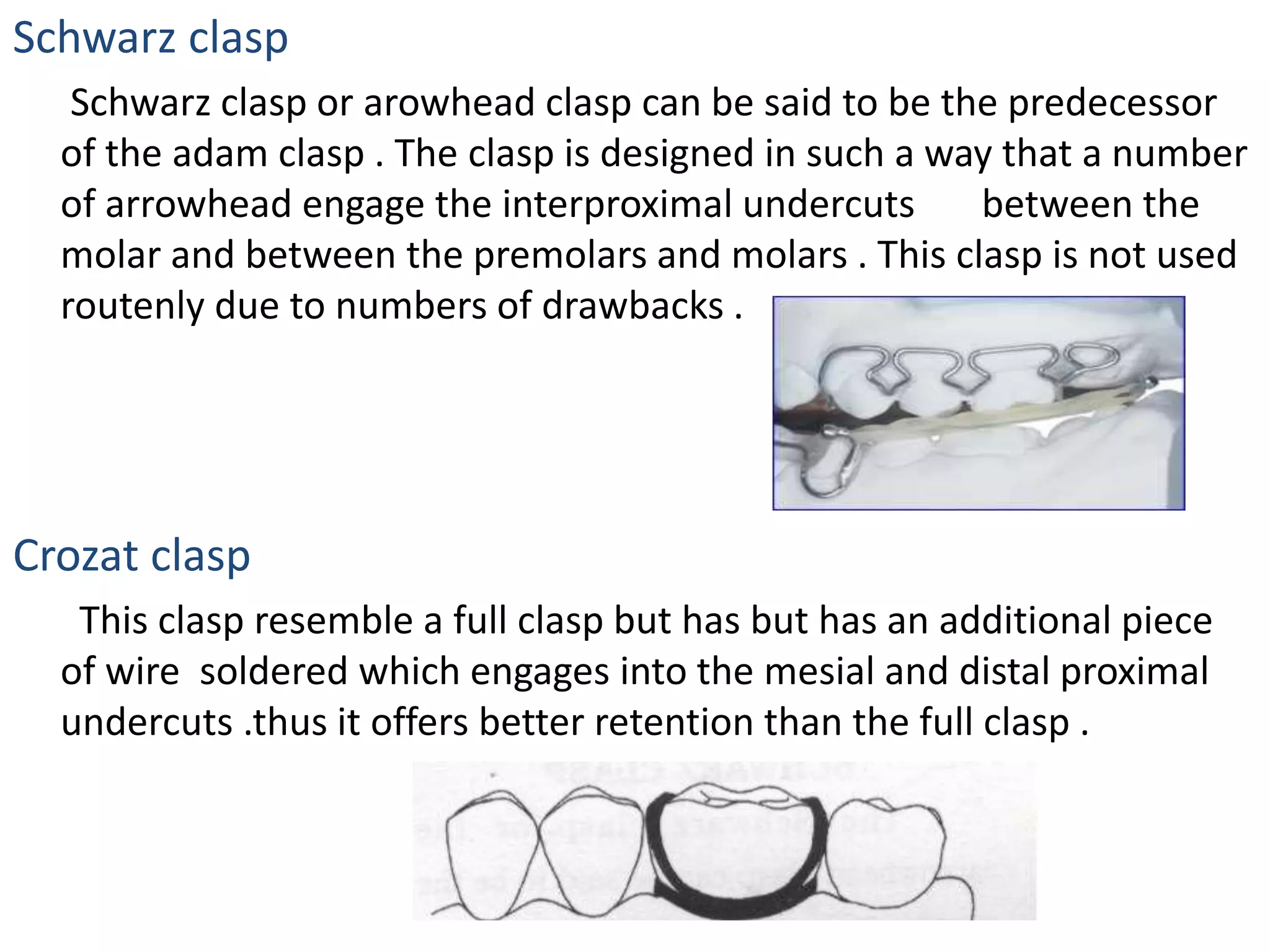 Removable orthodontic appliance | PPTX