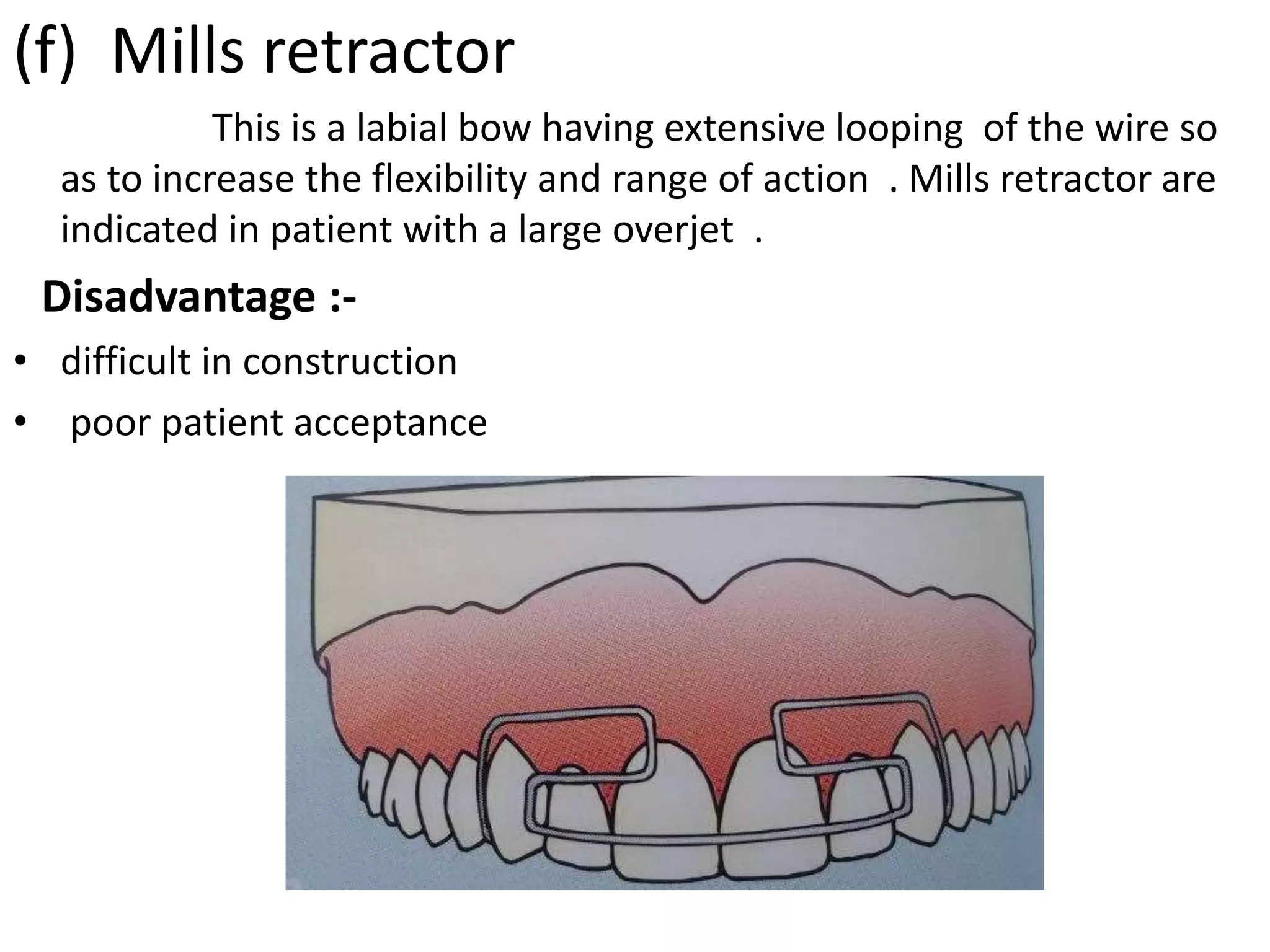 Removable orthodontic appliance | PPTX