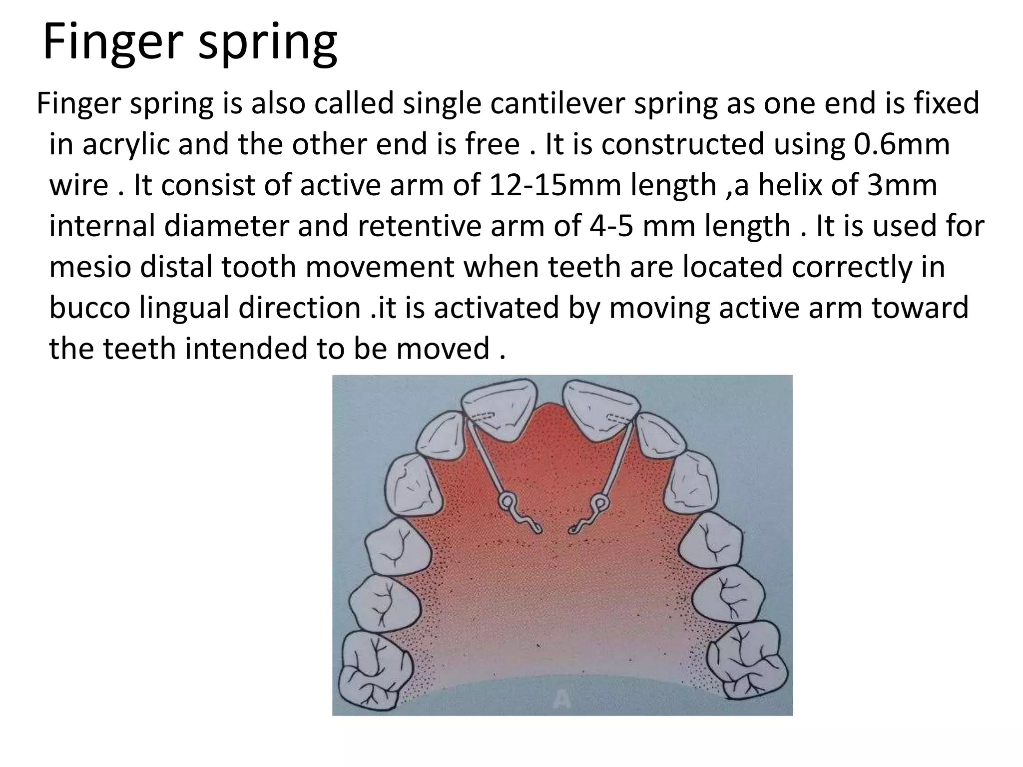 Removable orthodontic appliance | PPTX