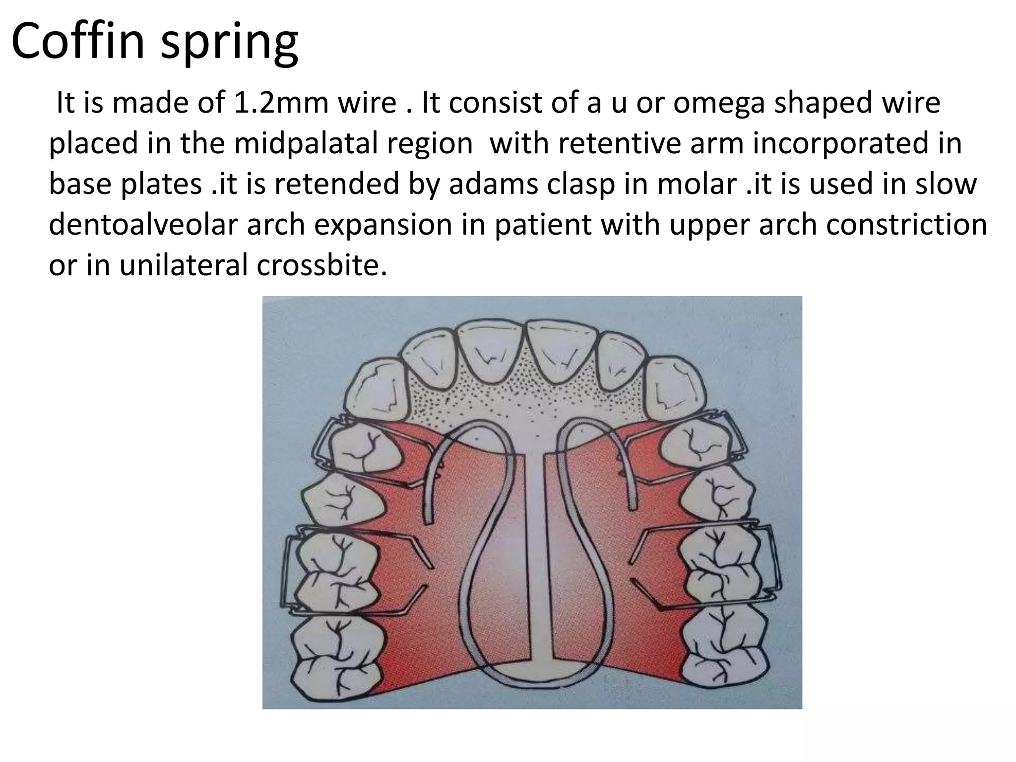 Removable orthodontic appliance | PPTX