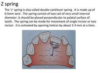 Removable orthodontic appliance | PPTX