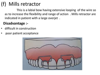 Removable orthodontic appliance | PPT