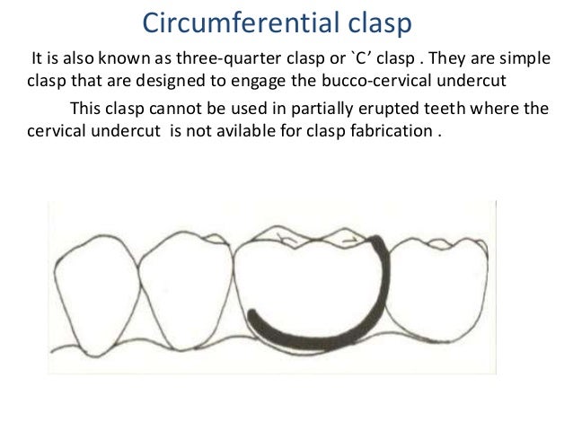 Removable orthodontic appliance