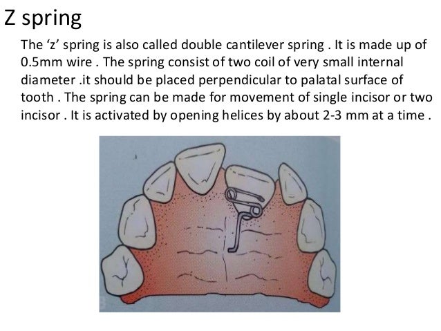 Removable orthodontic appliance