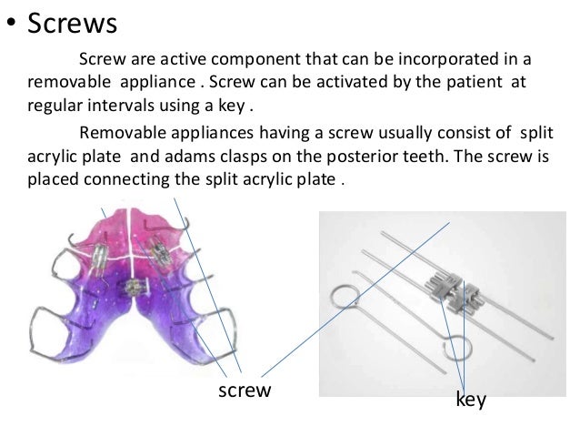 Removable orthodontic appliance