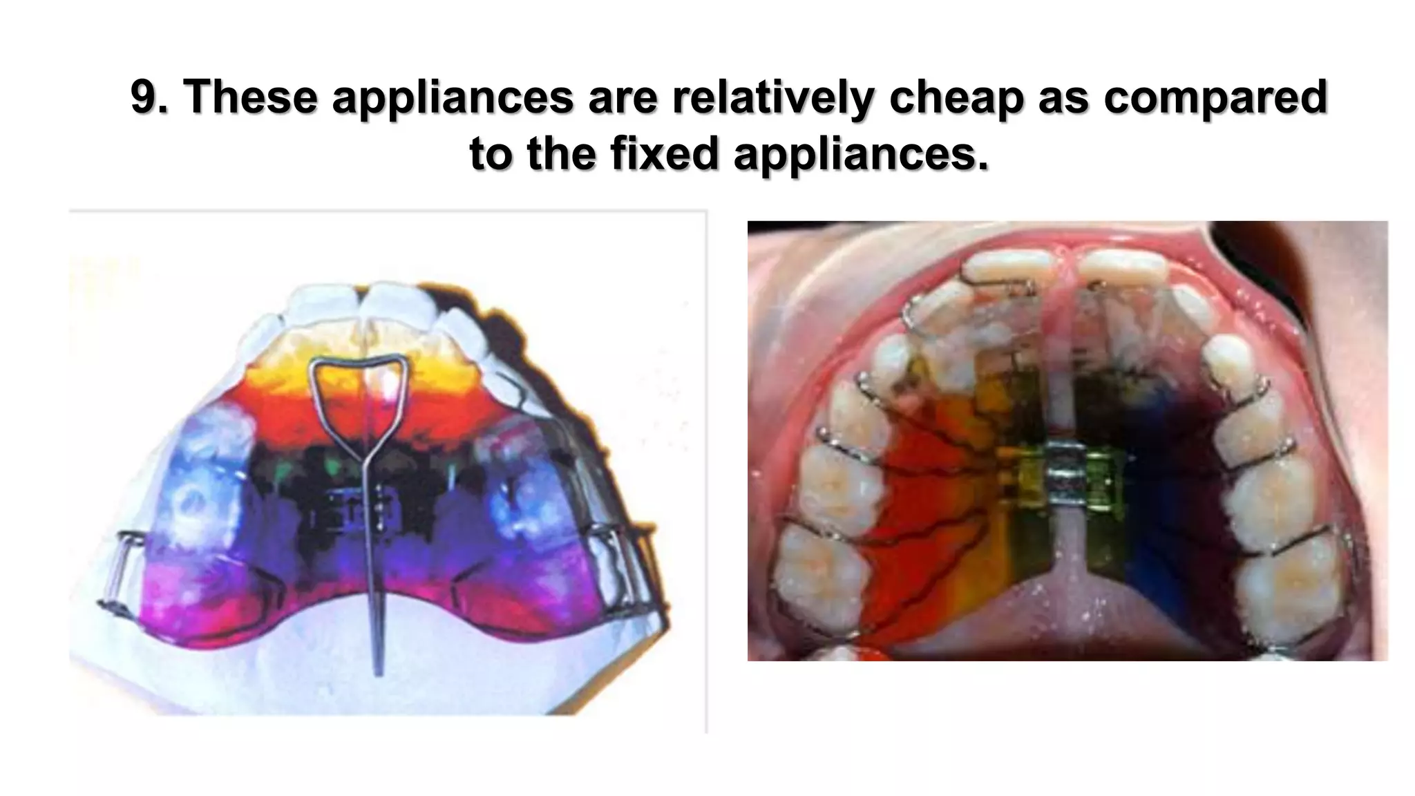 Removable orthodontic appliance | PPTX