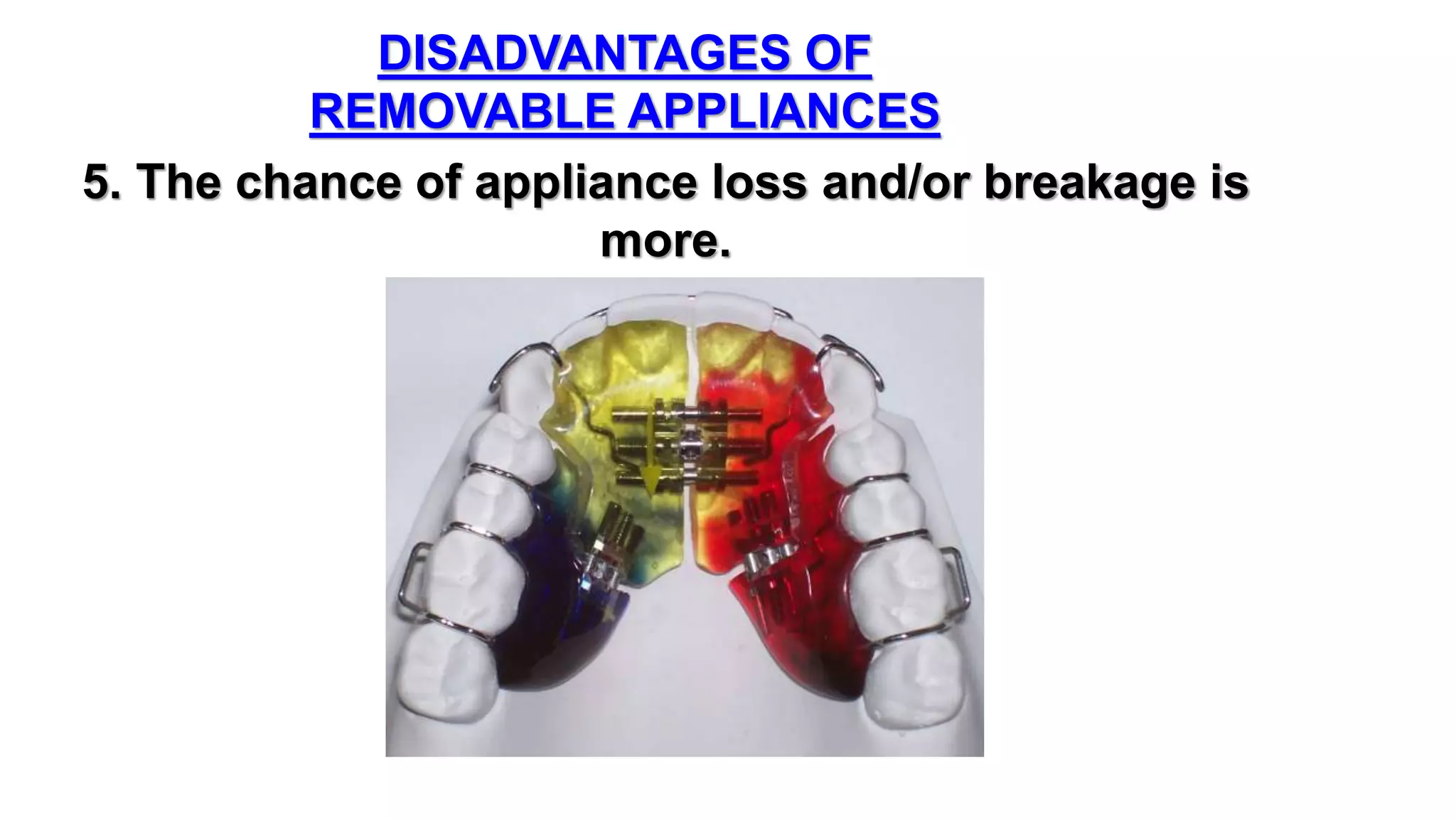 Removable orthodontic appliance | PPTX