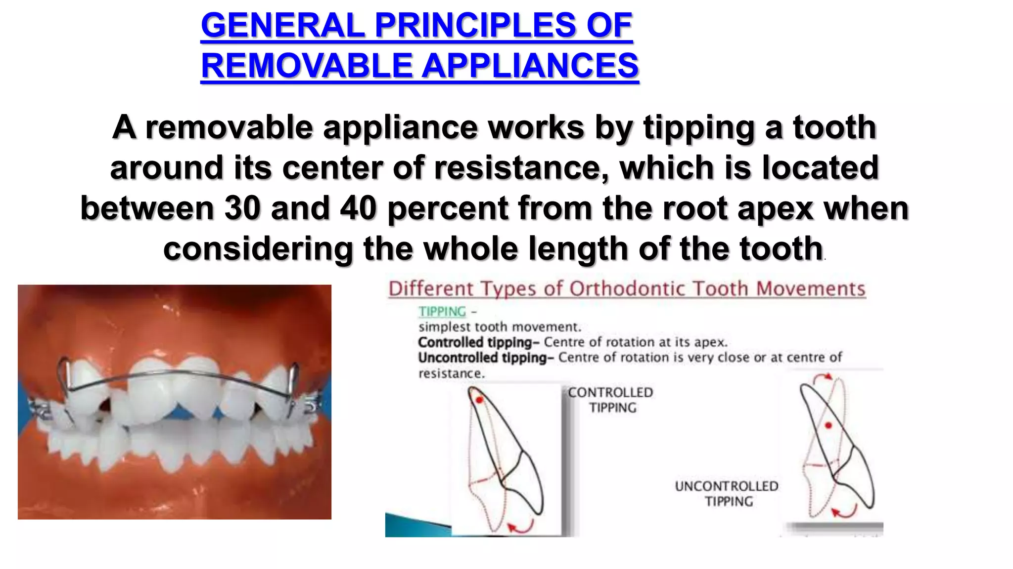 Removable orthodontic appliance | PPTX | Dental Health | Diseases and Conditions