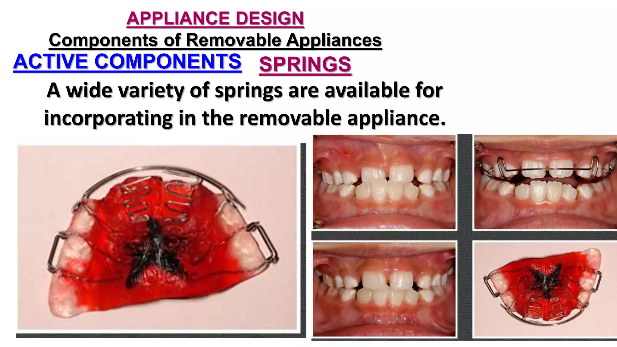 Removable orthodontic appliance | PPTX | Dental Health | Diseases and ...