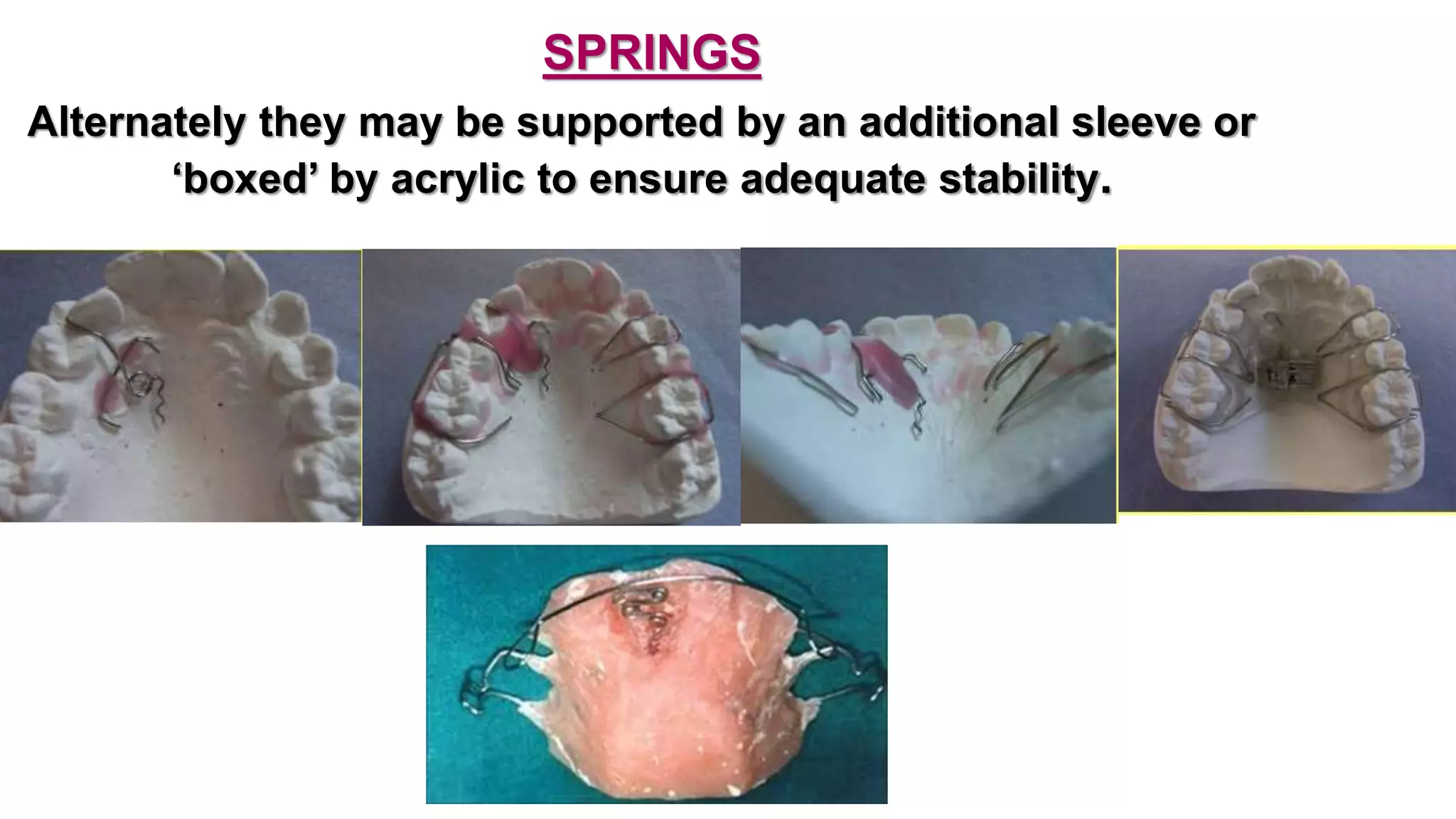 Removable orthodontic appliance | PPTX | Dental Health | Diseases and ...