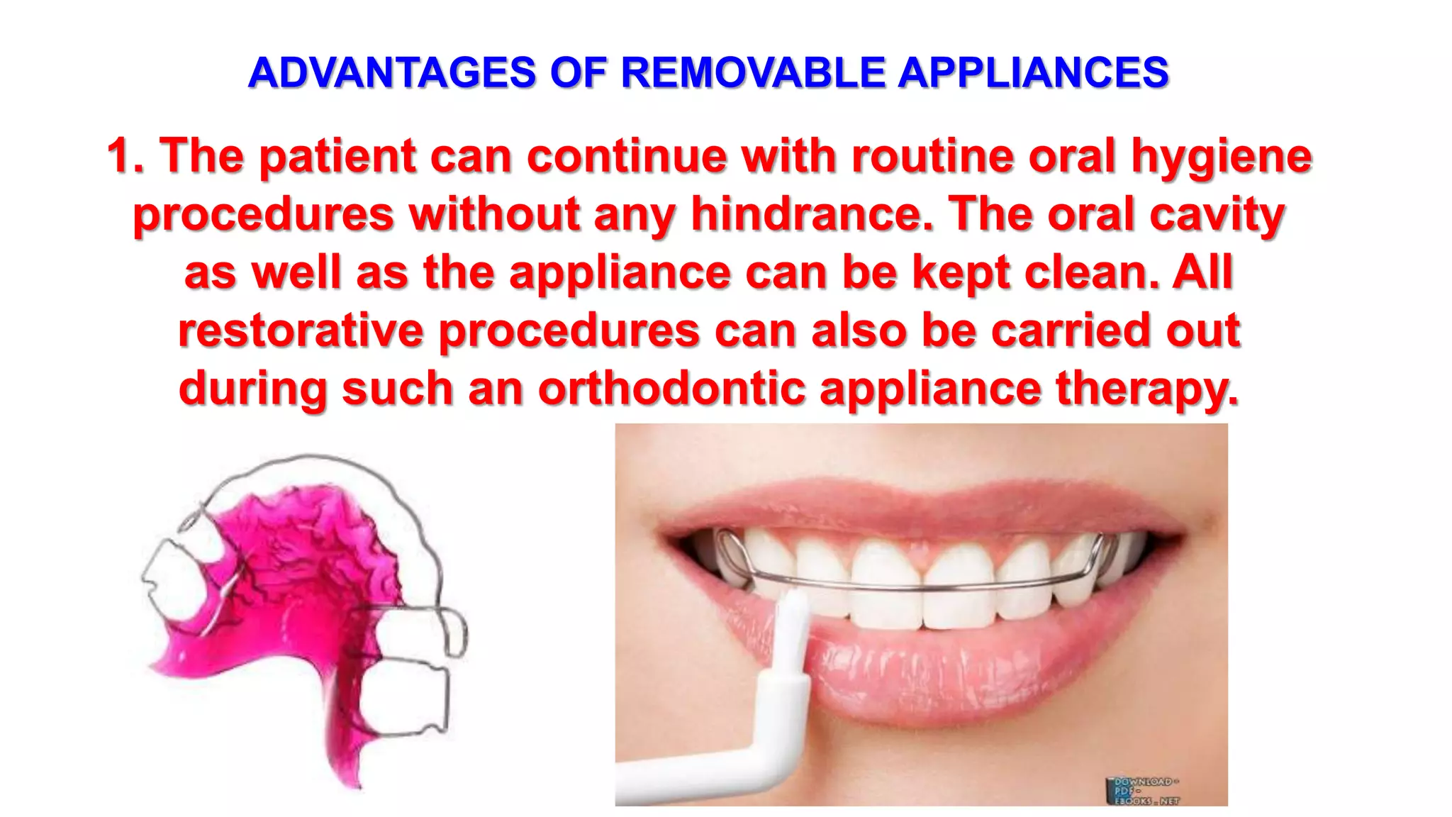 Removable orthodontic appliance | PPTX