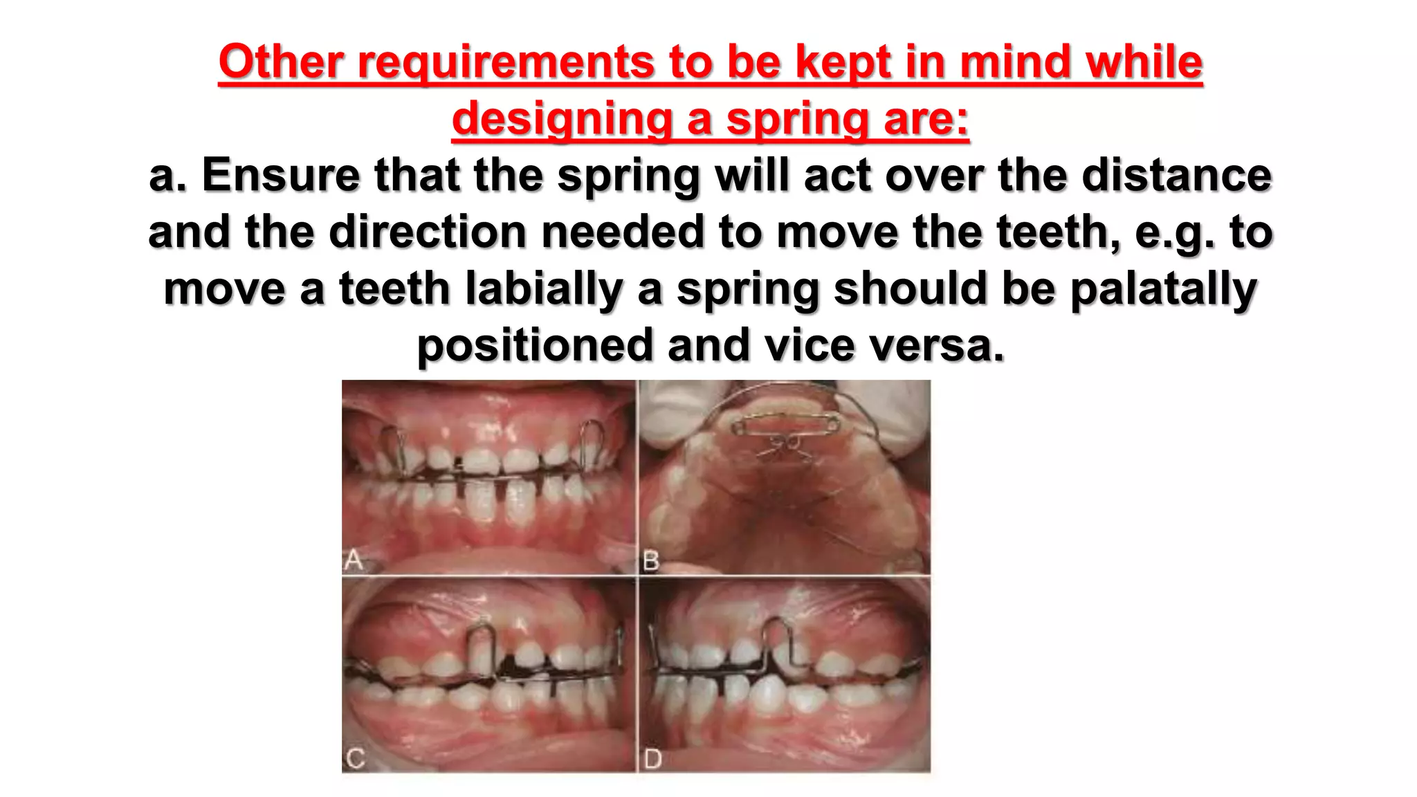 Removable orthodontic appliance | PPTX
