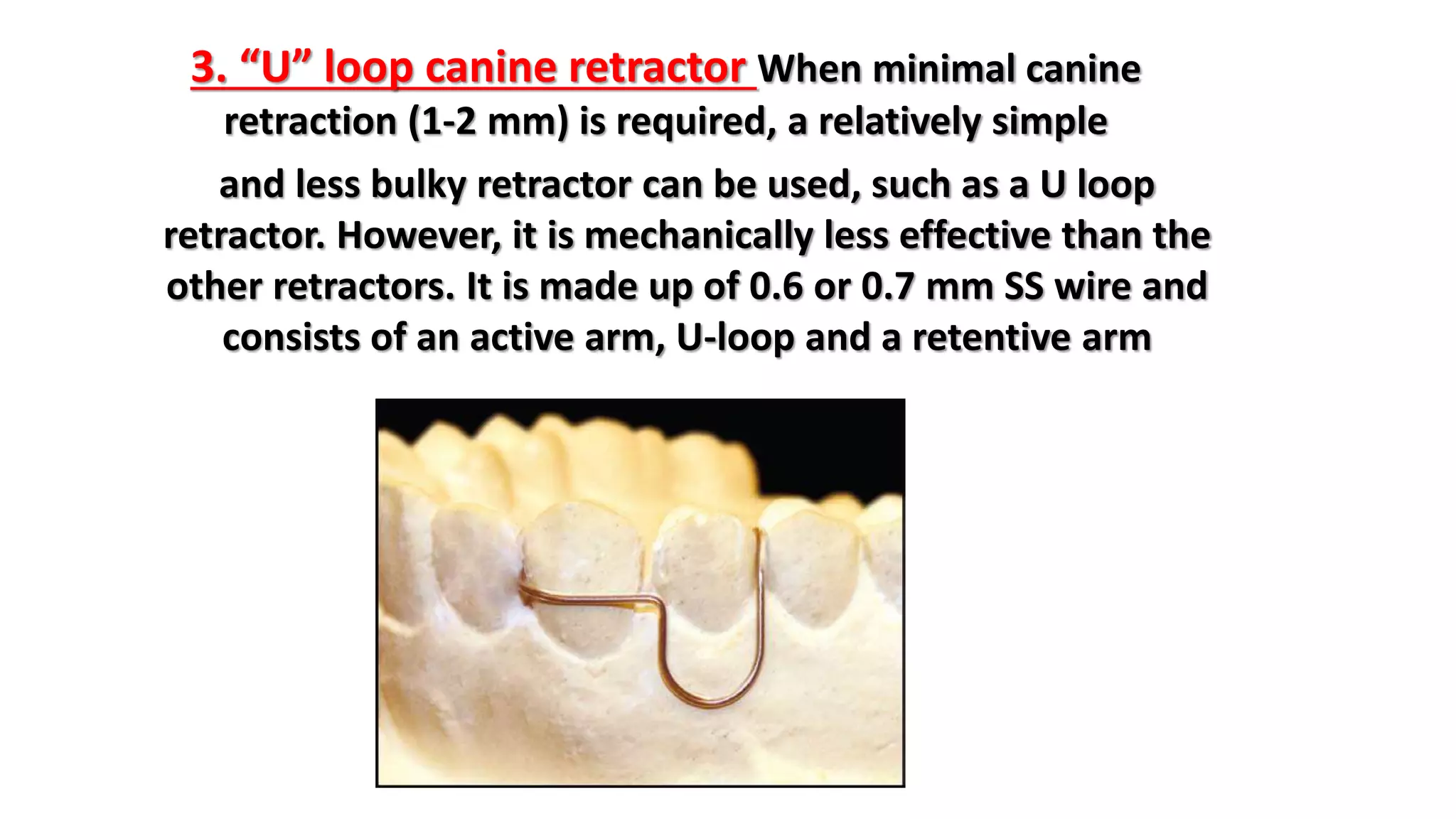 Removable orthodontic appliance | PPTX