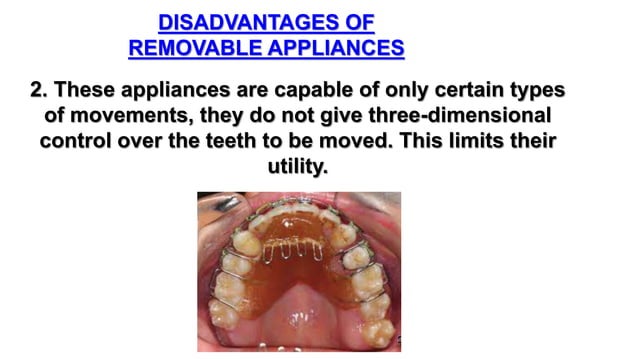 Removable orthodontic appliance | PPTX | Dental Health | Diseases and ...