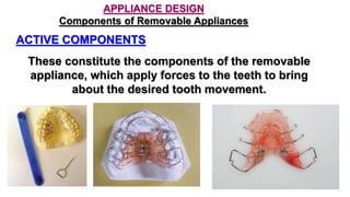 Removable orthodontic appliance | PPTX