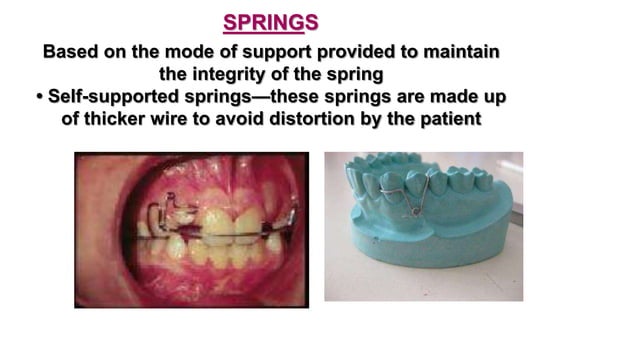 Removable orthodontic appliance | PPTX | Dental Health | Diseases and ...