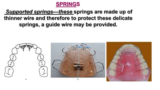 Removable orthodontic appliance | PPTX | Dental Health | Diseases and ...