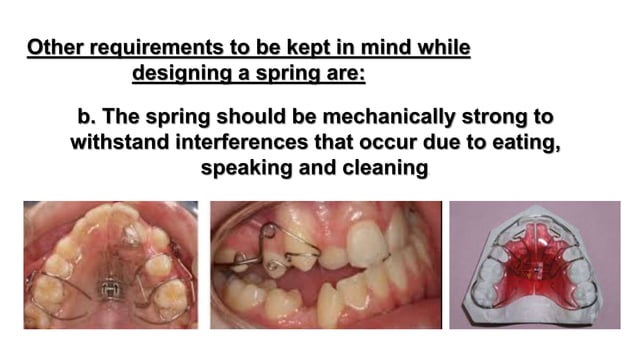 Removable orthodontic appliance | PPTX | Dental Health | Diseases and ...