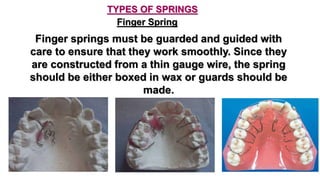 Removable orthodontic appliance | PPTX