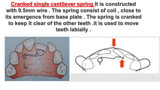 Removable orthodontic appliance | PPTX