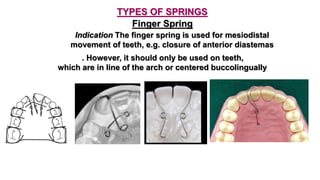 Removable orthodontic appliance | PPTX