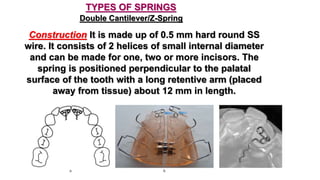 Removable orthodontic appliance | PPTX