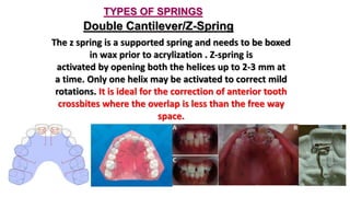 Removable orthodontic appliance | PPTX
