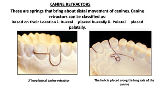 Removable orthodontic appliance | PPTX