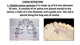Removable orthodontic appliance | PPTX