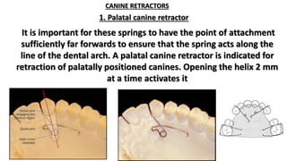 Removable orthodontic appliance | PPTX