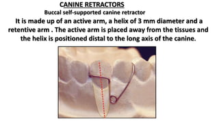Removable orthodontic appliance | PPTX