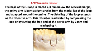 Removable orthodontic appliance | PPTX