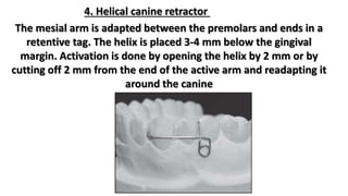 Removable orthodontic appliance | PPTX