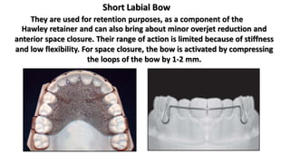 Removable orthodontic appliance | PPTX