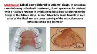 Removable orthodontic appliance | PPTX