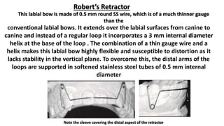 Removable orthodontic appliance | PPTX