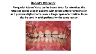 Removable orthodontic appliance | PPTX