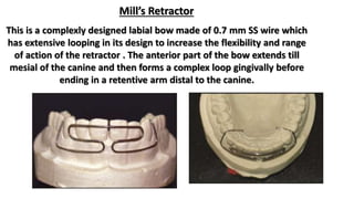 Removable orthodontic appliance | PPTX