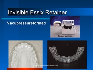 Removable orthodontic appliances. /certified fixed orthodontic courses ...