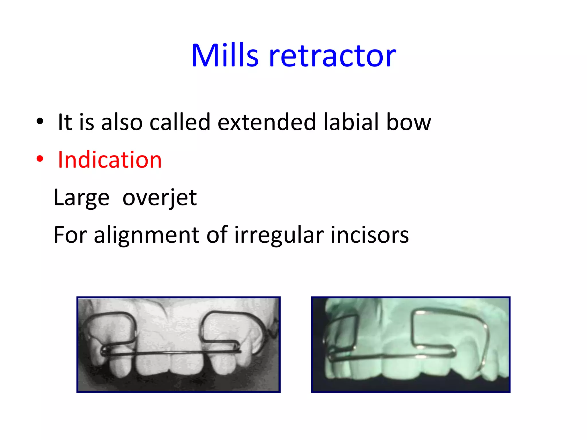 Removable Orthodontic Appliances Analhaq Shaikh | PPTX