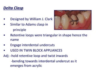 Removable Orthodontic Appliances Analhaq Shaikh | PPT
