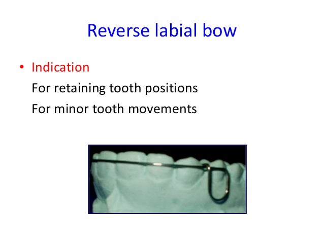 Removable Orthodontic Appliances Analhaq Shaikh