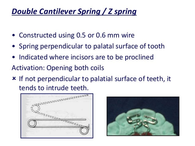 Removable Orthodontic Appliances Analhaq Shaikh