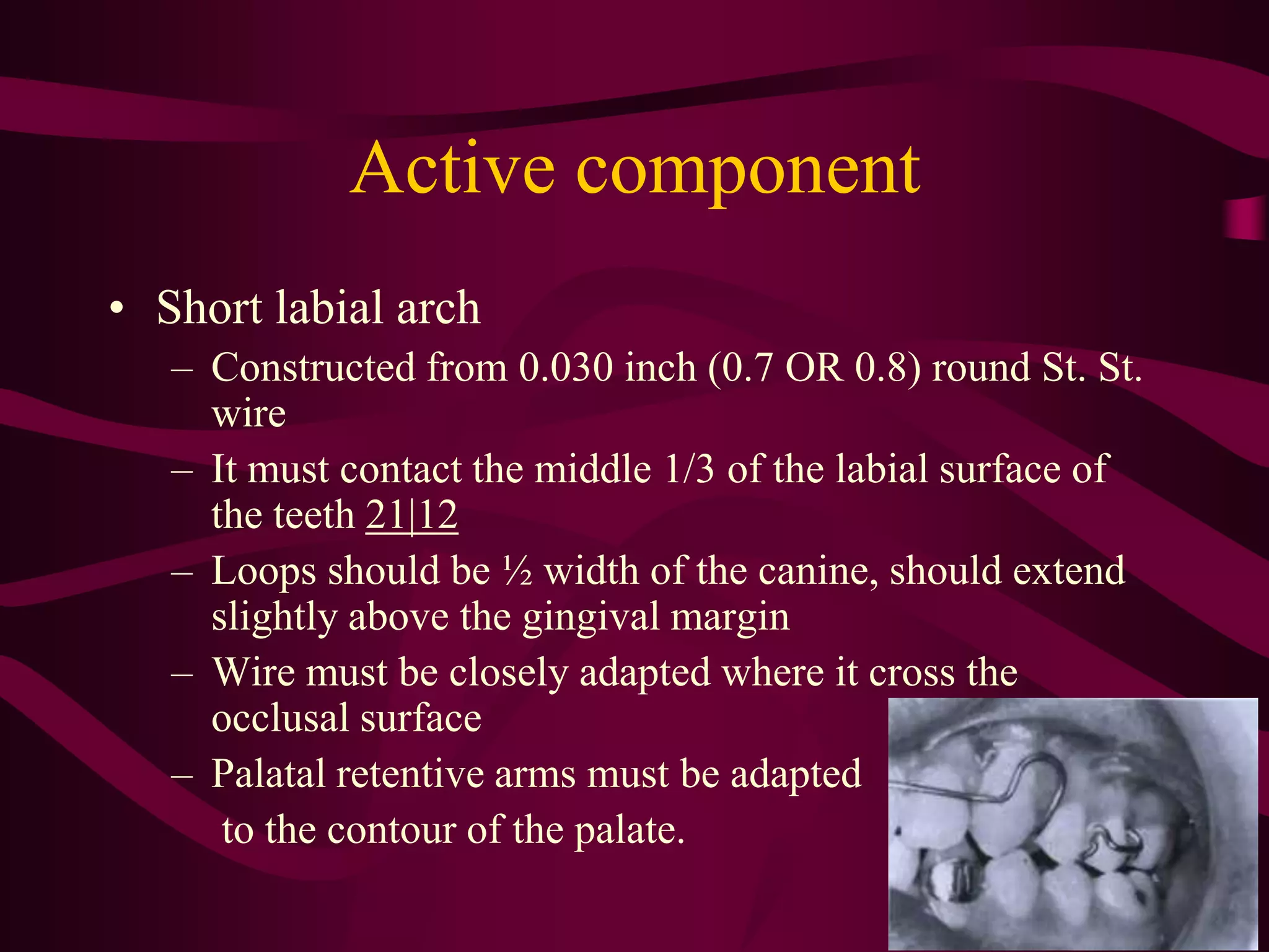 Removable Orthodontic Appliances | PDF