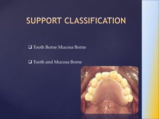 Removable Partial Denture Made In U.S.A | PPT