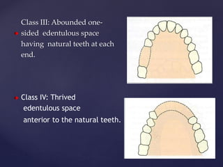 Removable Partial Denture Made In U.S.A | PPT